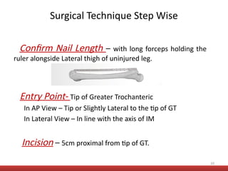 Proximal Femoral Reconstruction N surgi.pptx