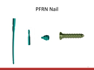 Proximal Femoral Reconstruction N surgi.pptx