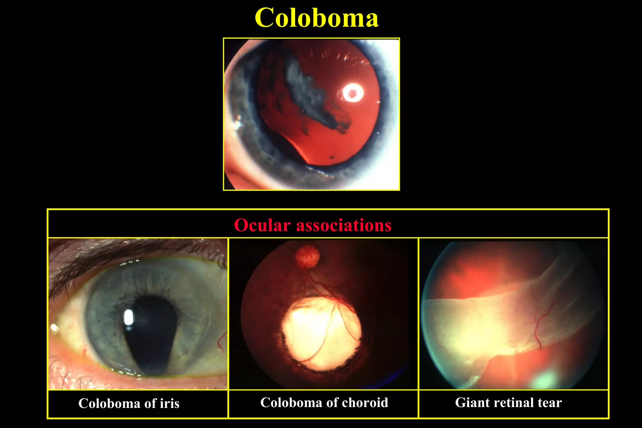 25 abnormal lens shape | PPT