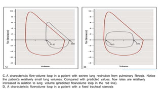 pulmonary Function Test | PPTX | Lung and Respiratory Health | Diseases ...