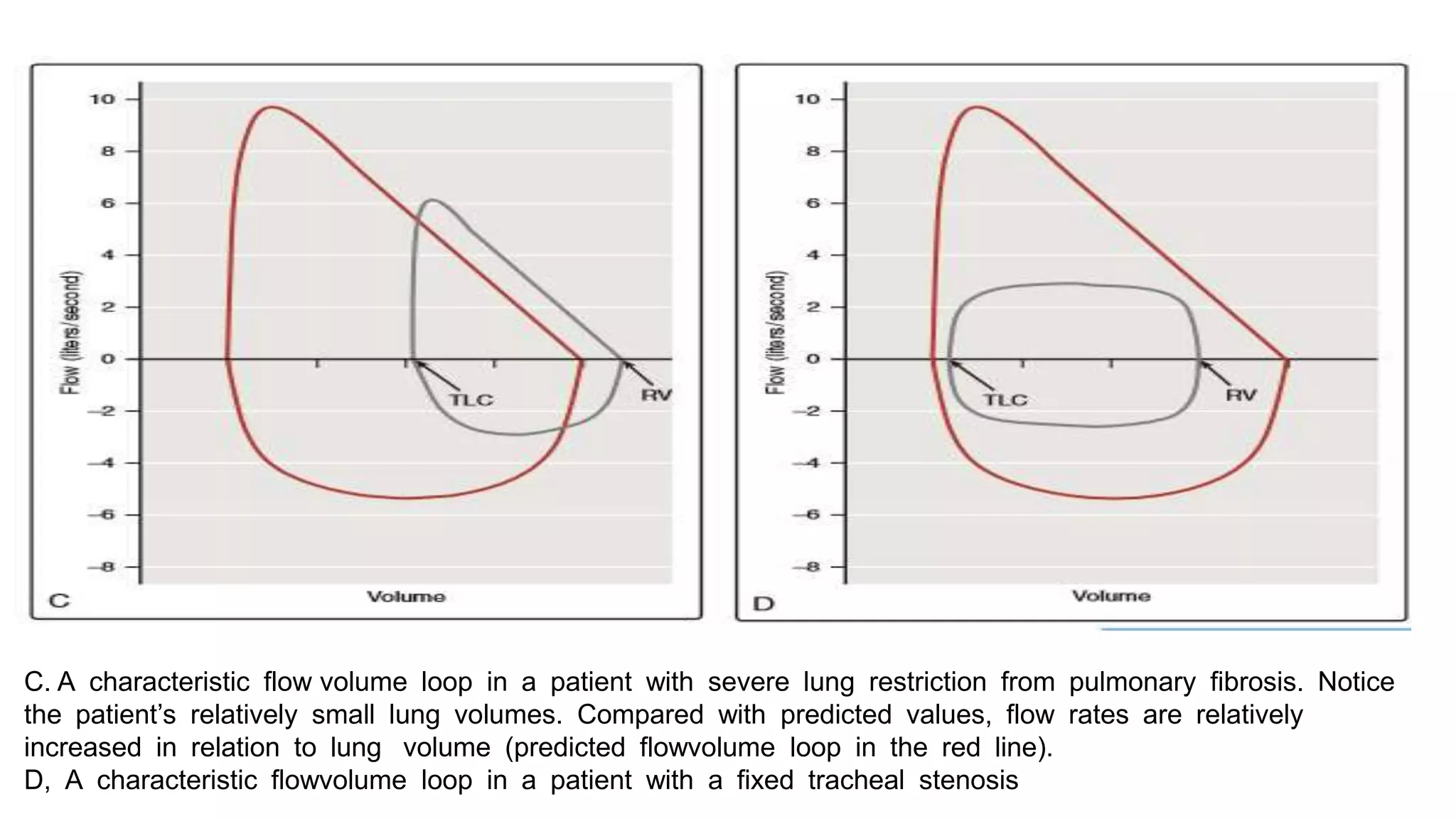 PFT 3rd year FDPS.pptx | Lung and Respiratory Health | Diseases and ...