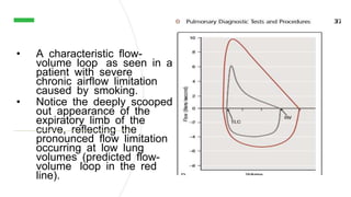 PFT 3rd year FDPS.pptx | Lung and Respiratory Health | Diseases and ...