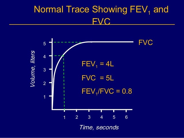 Pulmonary Function Test