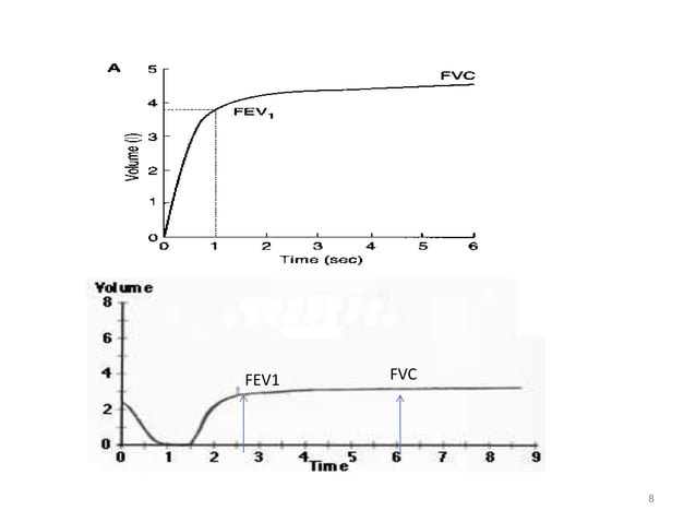 Pft interpretation | PPTX | Lung and Respiratory Health | Diseases and ...