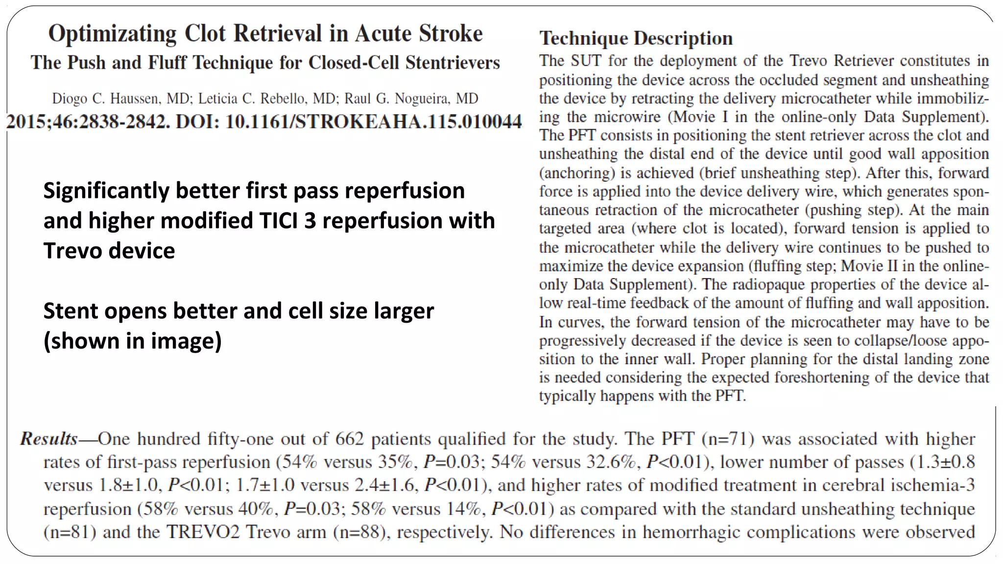 Push and Puff Technique for Mechanical Thrombectomy | PPT