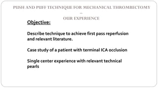 Push and Puff Technique for Mechanical Thrombectomy | PPT