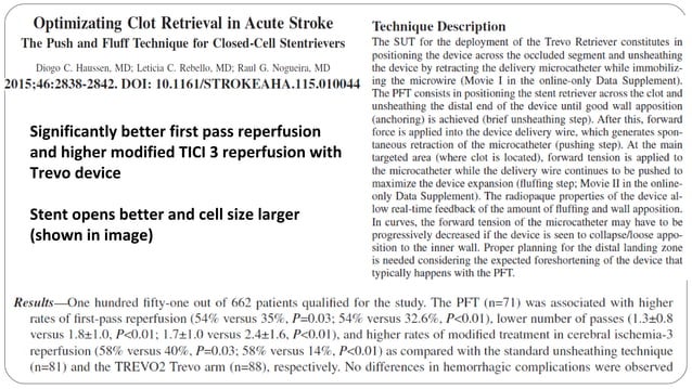 Push and Puff Technique for Mechanical Thrombectomy | PPT