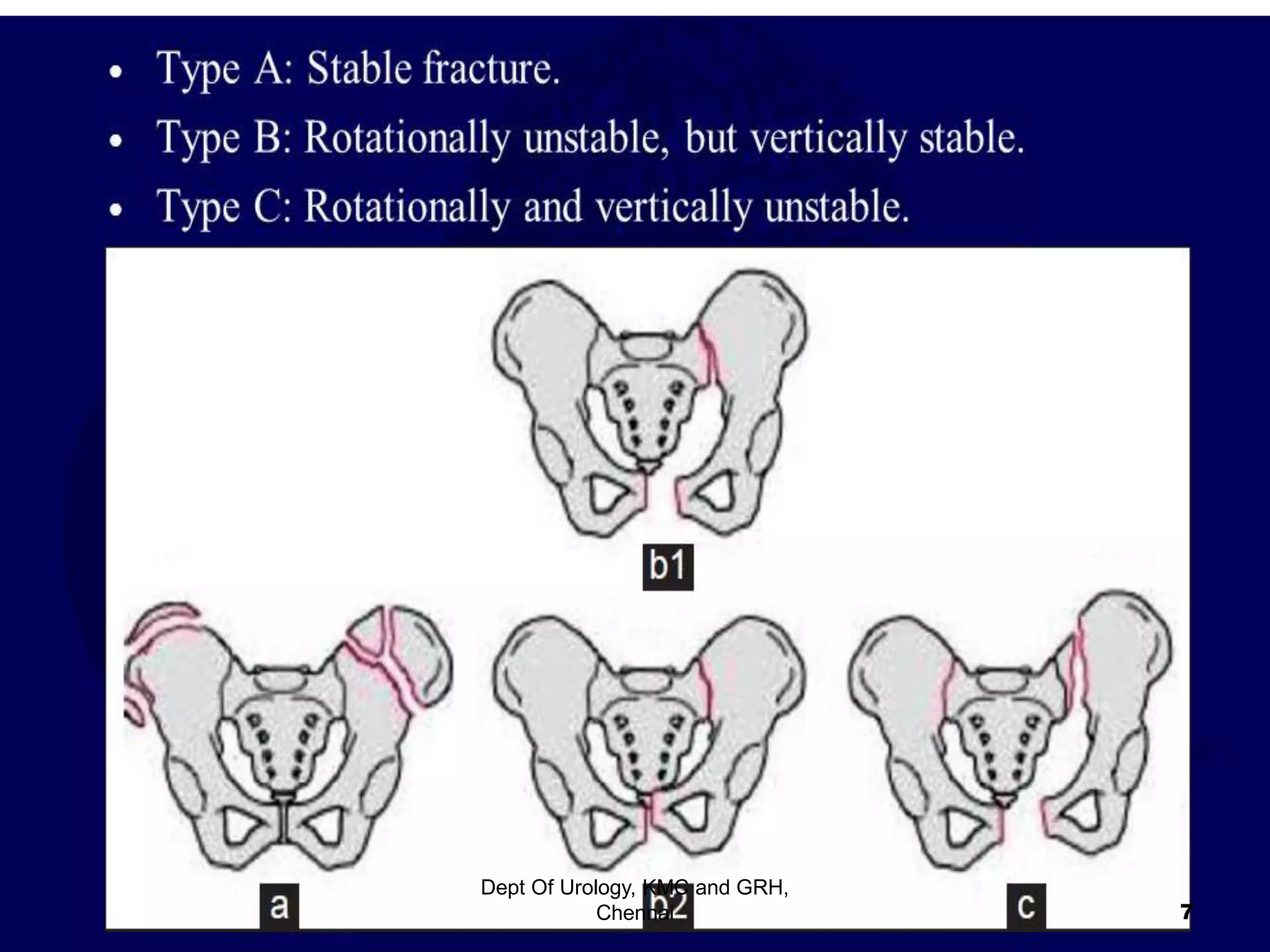Pfudd classification | PDF