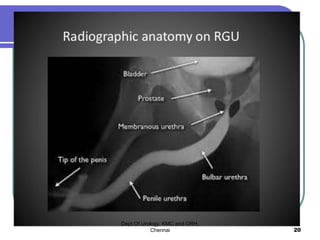 Pfudd classification | PDF