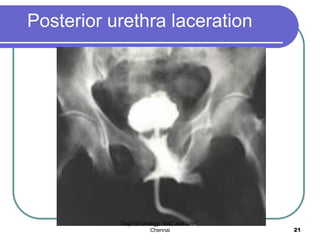 Pfudd classification | PDF