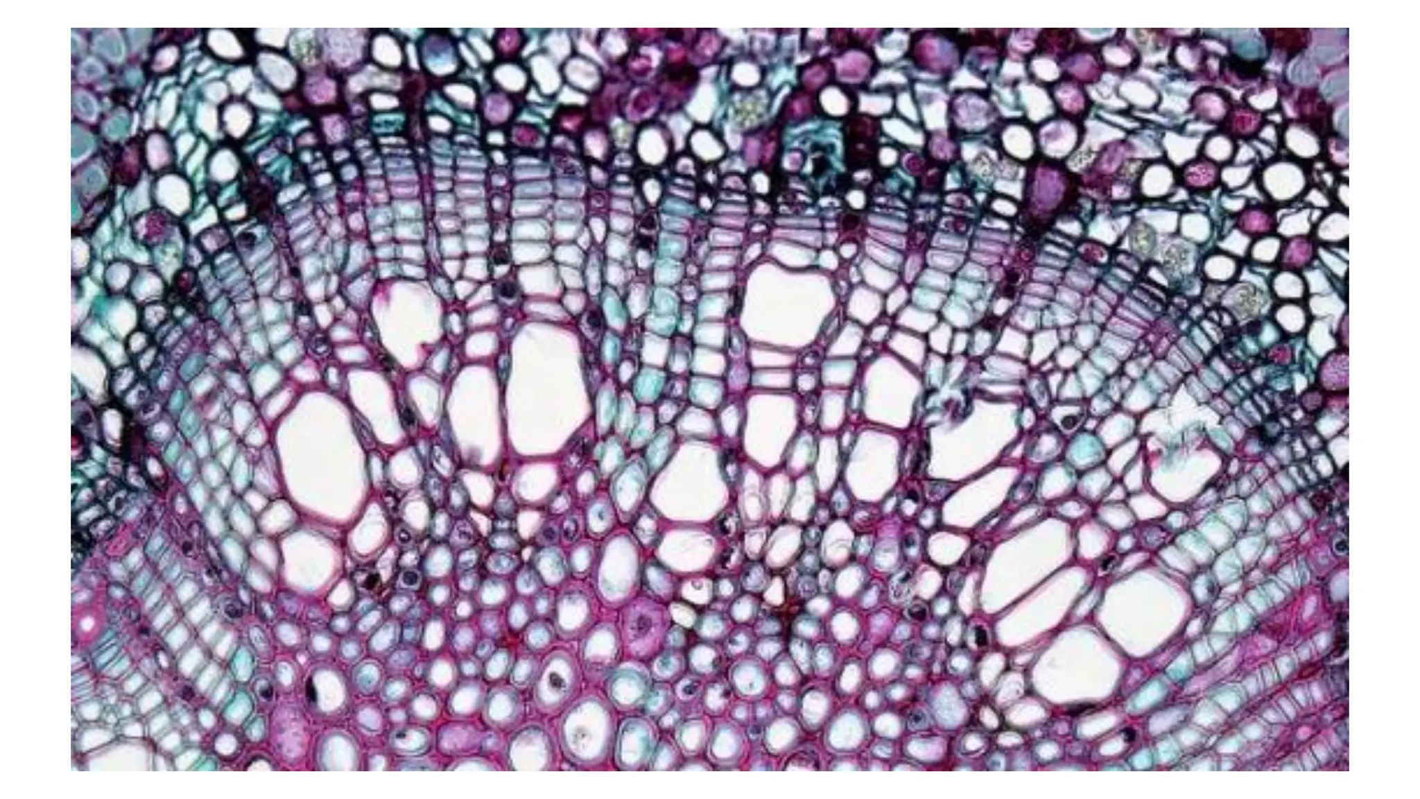 PG Anatomy Node nodal anatomy Cambium Differentiation | PDF