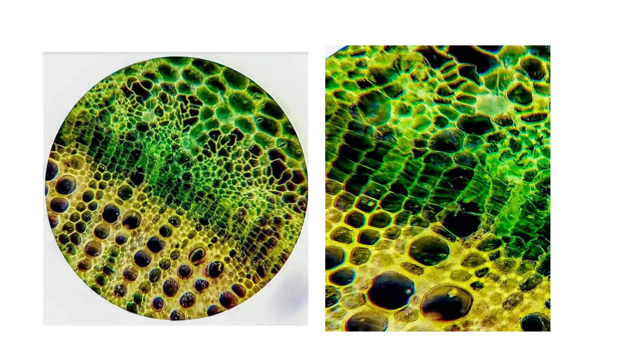 PG Anatomy Node nodal anatomy Cambium Differentiation | PDF