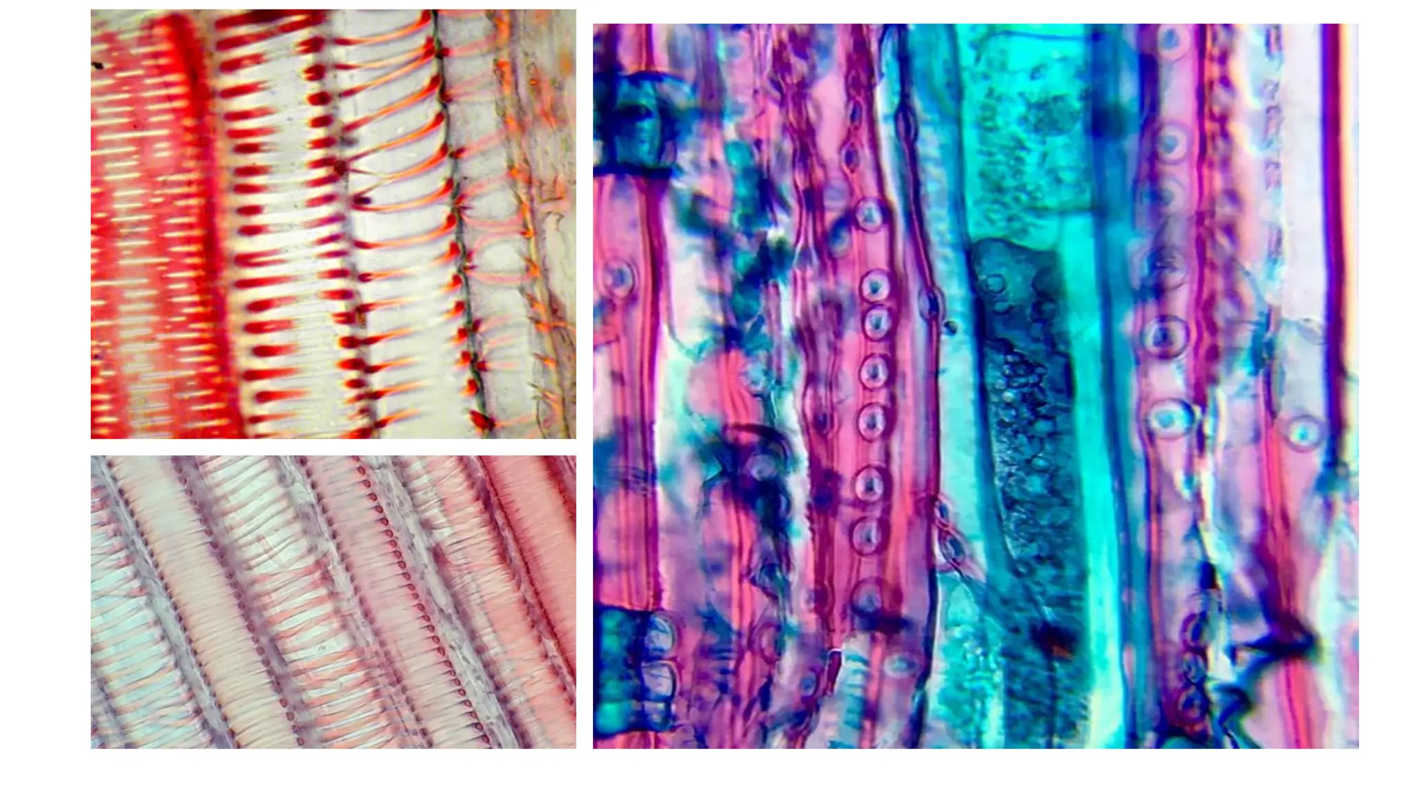 PG Anatomy Node nodal anatomy Cambium Differentiation | PDF