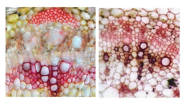 PG Anatomy Node nodal anatomy Cambium Differentiation | PDF