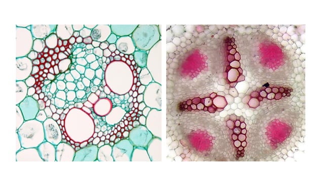 PG Anatomy Node nodal anatomy Cambium Differentiation | PDF
