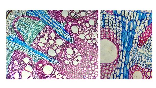 PG Anatomy Node nodal anatomy Cambium Differentiation | PDF