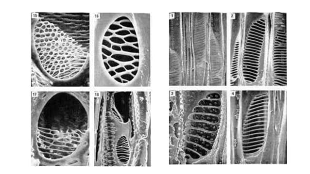 PG Anatomy Node nodal anatomy Cambium Differentiation | PDF
