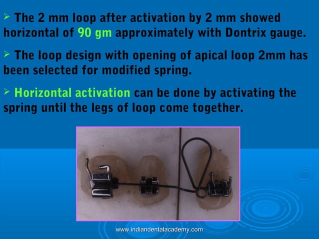 Pg canine retraction spring | PPT | Geology | Science