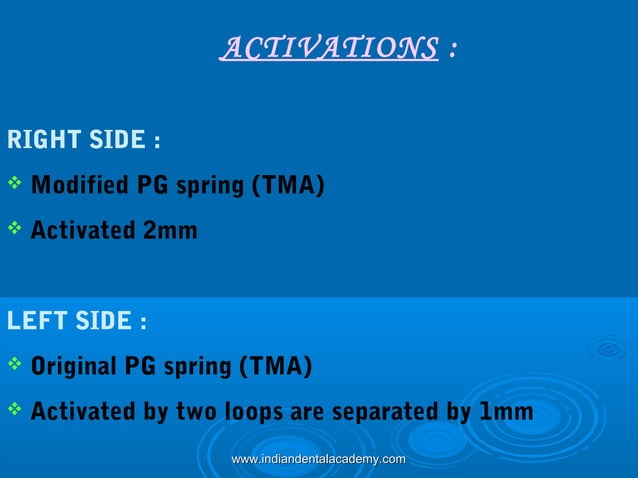 Pg canine retraction spring | PPT | Geology | Science