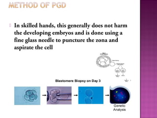 PGD its role in IVF/ICSI | PPT