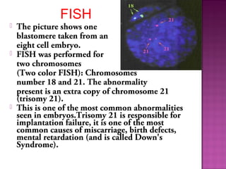 PGD its role in IVF/ICSI | PPT