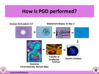 Pre-implantation Genetic Diagnosis ( PGD ) | PDF