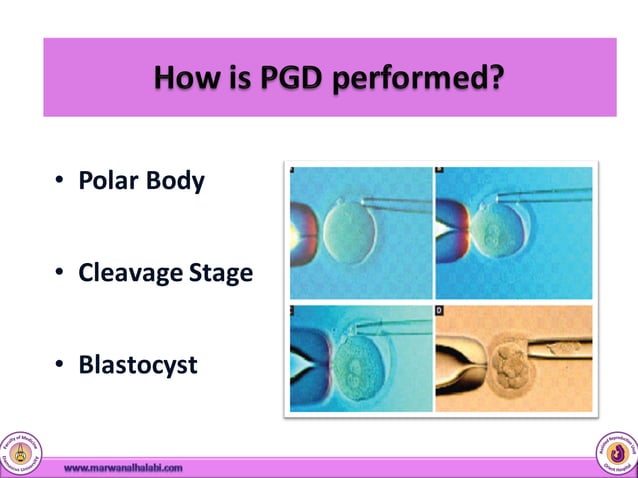 Pre-implantation Genetic Diagnosis ( PGD ) | PDF | Blood Disorders | Diseases and Conditions