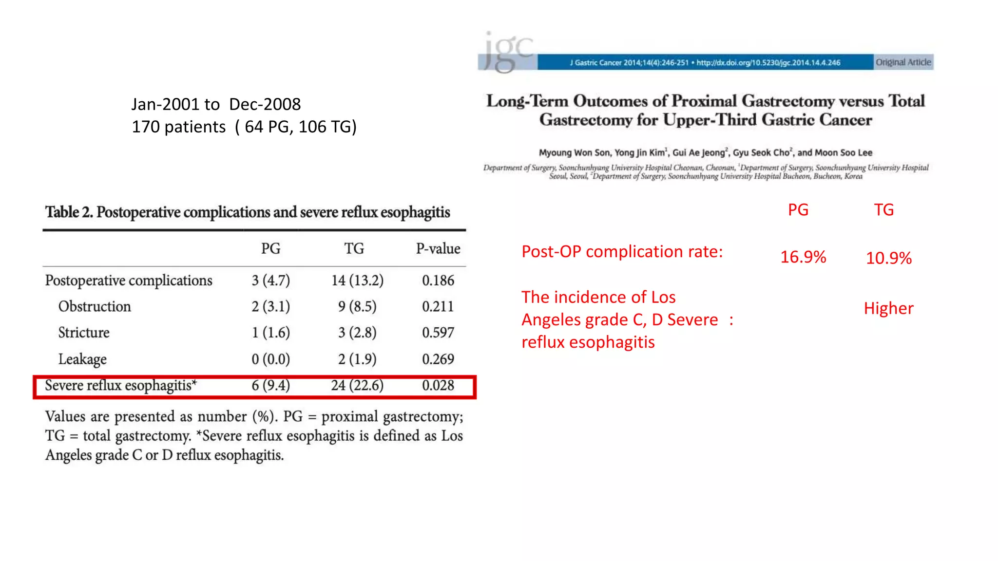 Proximal Gastrectomy for Early Gastric Cancer | PPTX