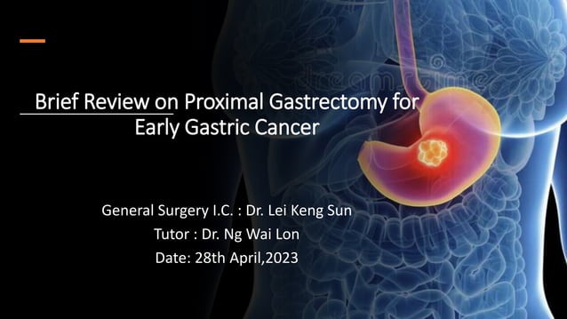Proximal Gastrectomy for Early Gastric Cancer | PPT | Free Download