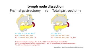 Proximal Gastrectomy for Early Gastric Cancer | PPTX