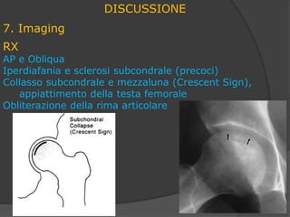 Osteonecrosi testa femorale caso clinico | PPT