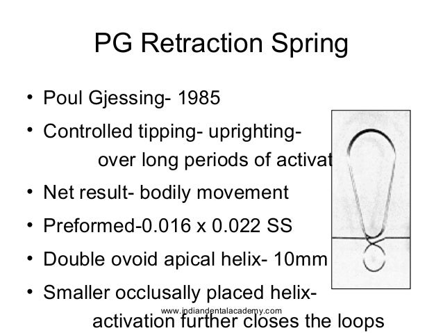 Pg retraction spring /certified fixed orthodontic courses by Indian d…
