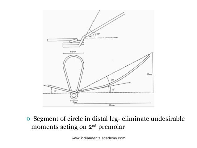 Pg retraction spring /certified fixed orthodontic courses by Indian d…