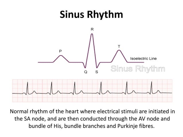 PH1.30 Describe the mechanisms of action, types, doses, side effects ...