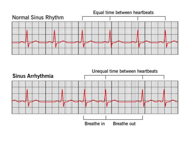 PH1.30 Describe the mechanisms of action, types, doses, side effects ...