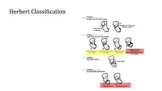Herbert Classification Wrist Joint Normal Ppt Powerpoint Presentation ...