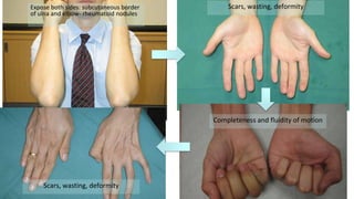 Approach to Hand Conditions | PPT