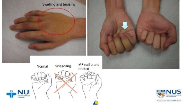 Approach to Hand Conditions