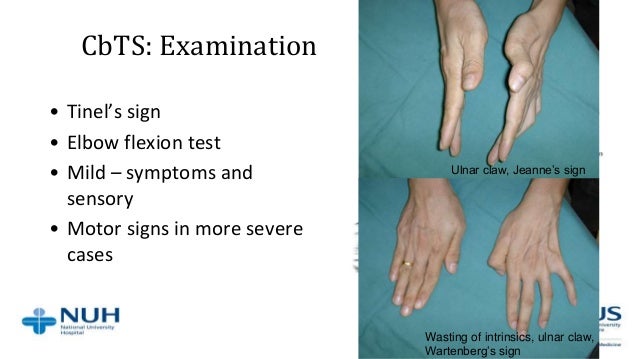 Approach to Hand Conditions