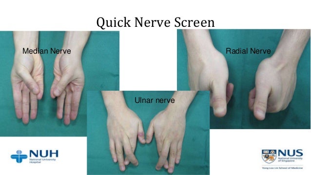 Approach to Hand Conditions