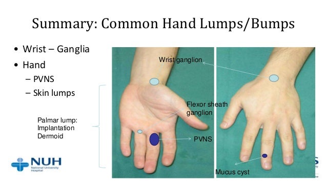 Approach to Hand Conditions