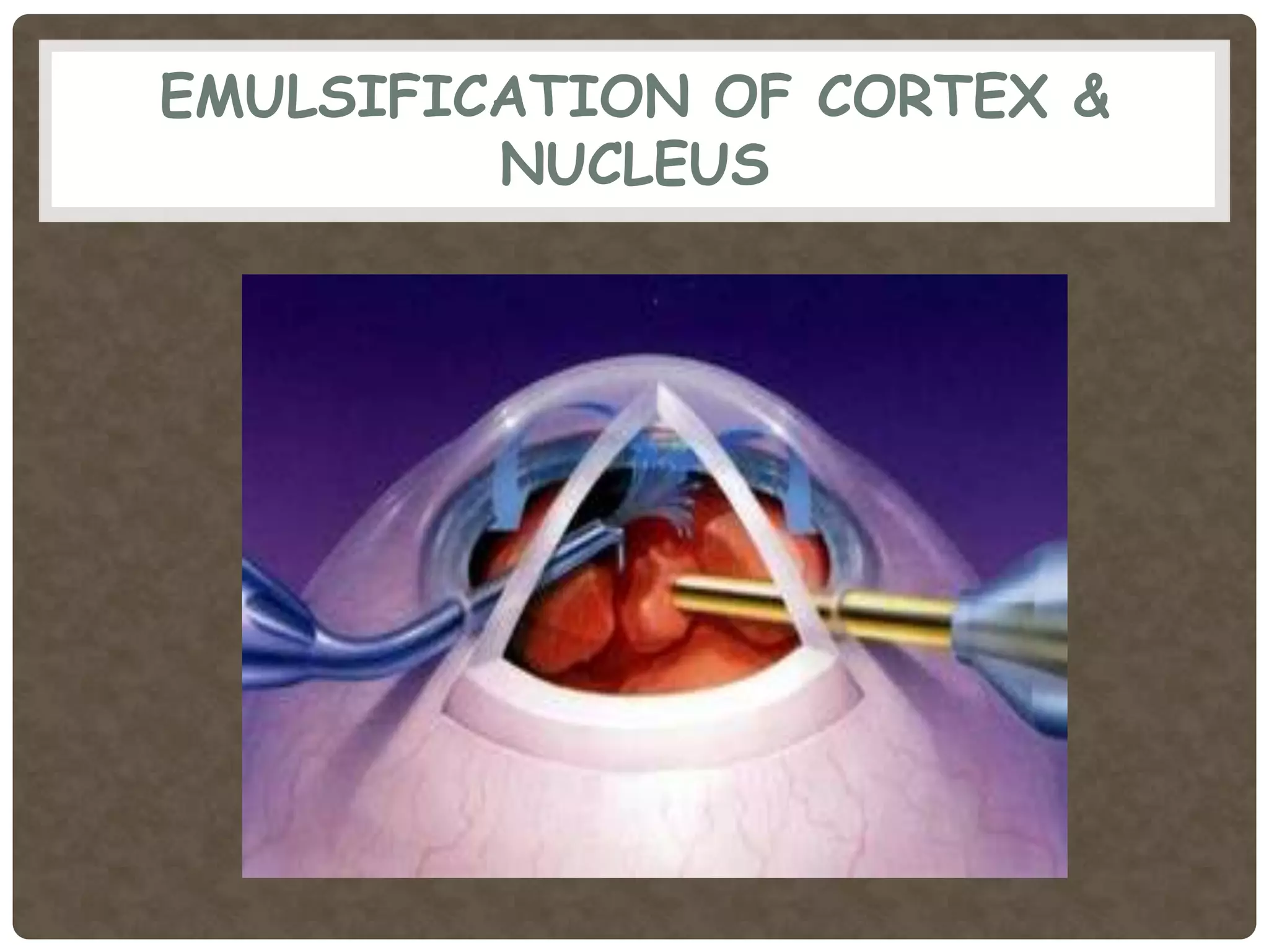 Phacoemulsification | PPTX