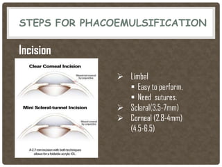 Phacoemulsification | PPTX