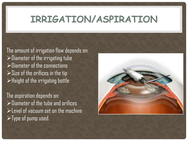 Phacoemulsification | PPTX