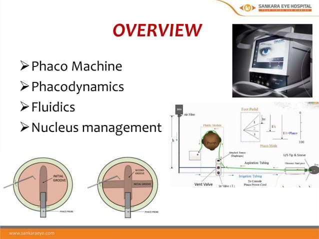 PHACO | PPTX | Eye and Vision Conditions | Diseases and Conditions
