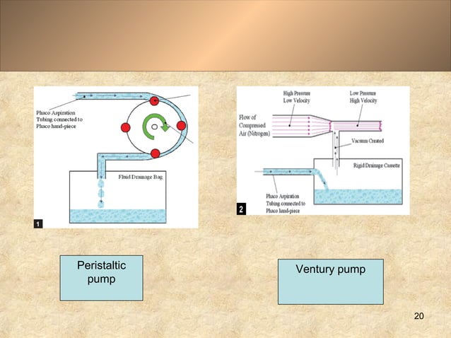 Phacodynamics | PPT | Eye and Vision Conditions | Diseases and Conditions