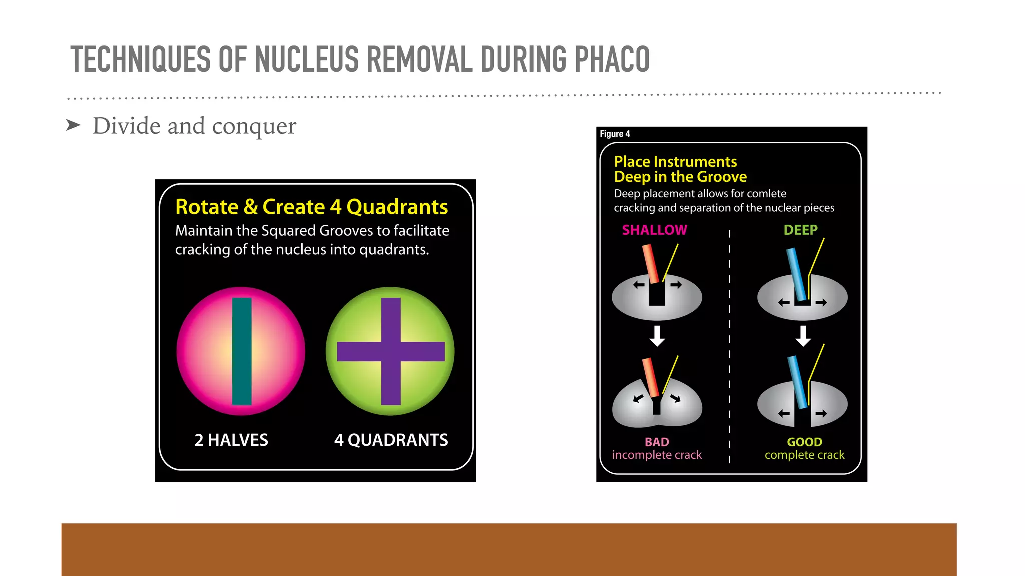 Phacoemulsification: Phacodynamics | PDF