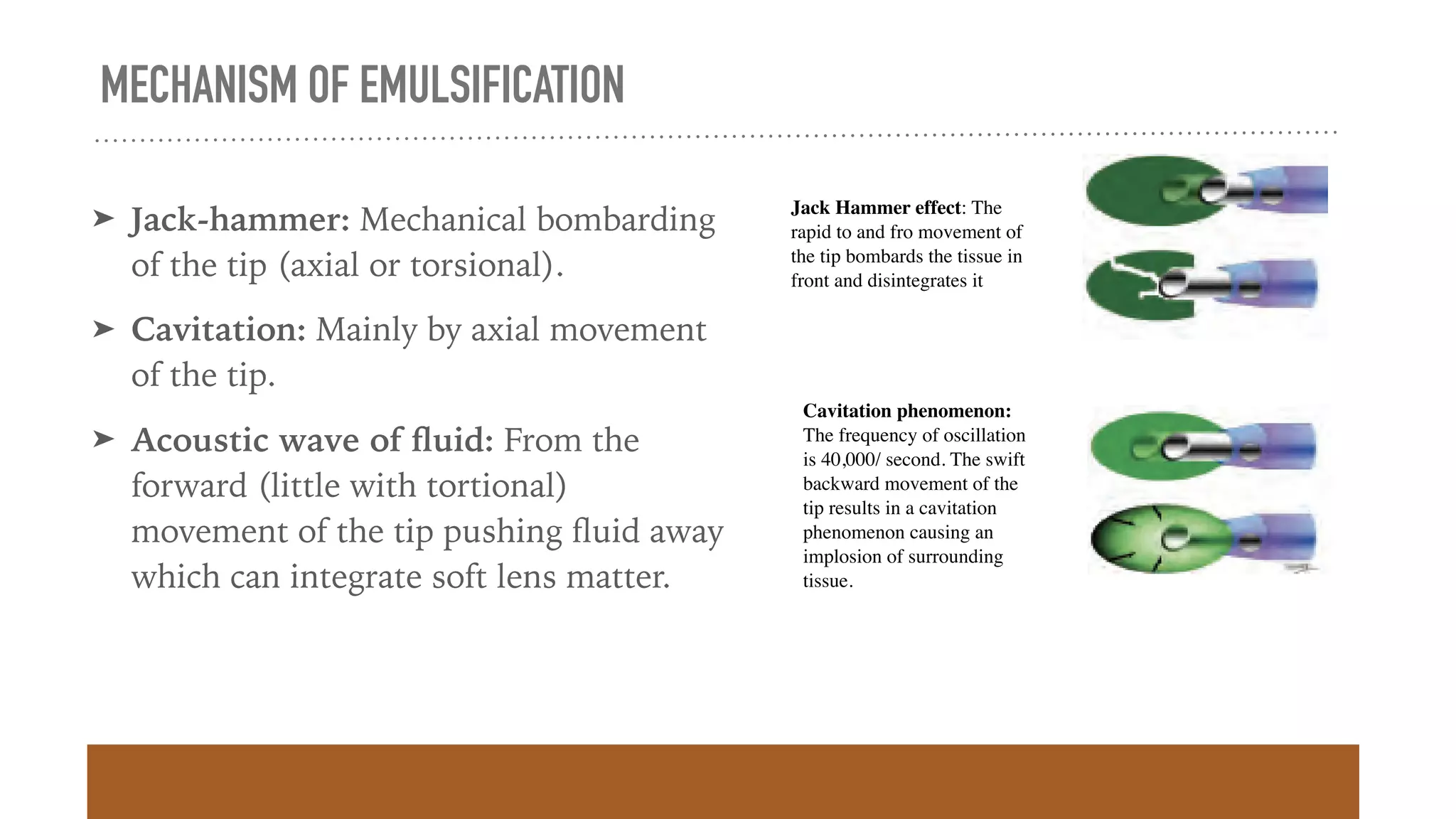Phacoemulsification: Phacodynamics | PDF