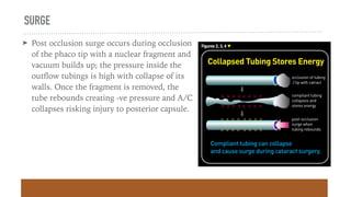 Phacoemulsification: Phacodynamics | PDF