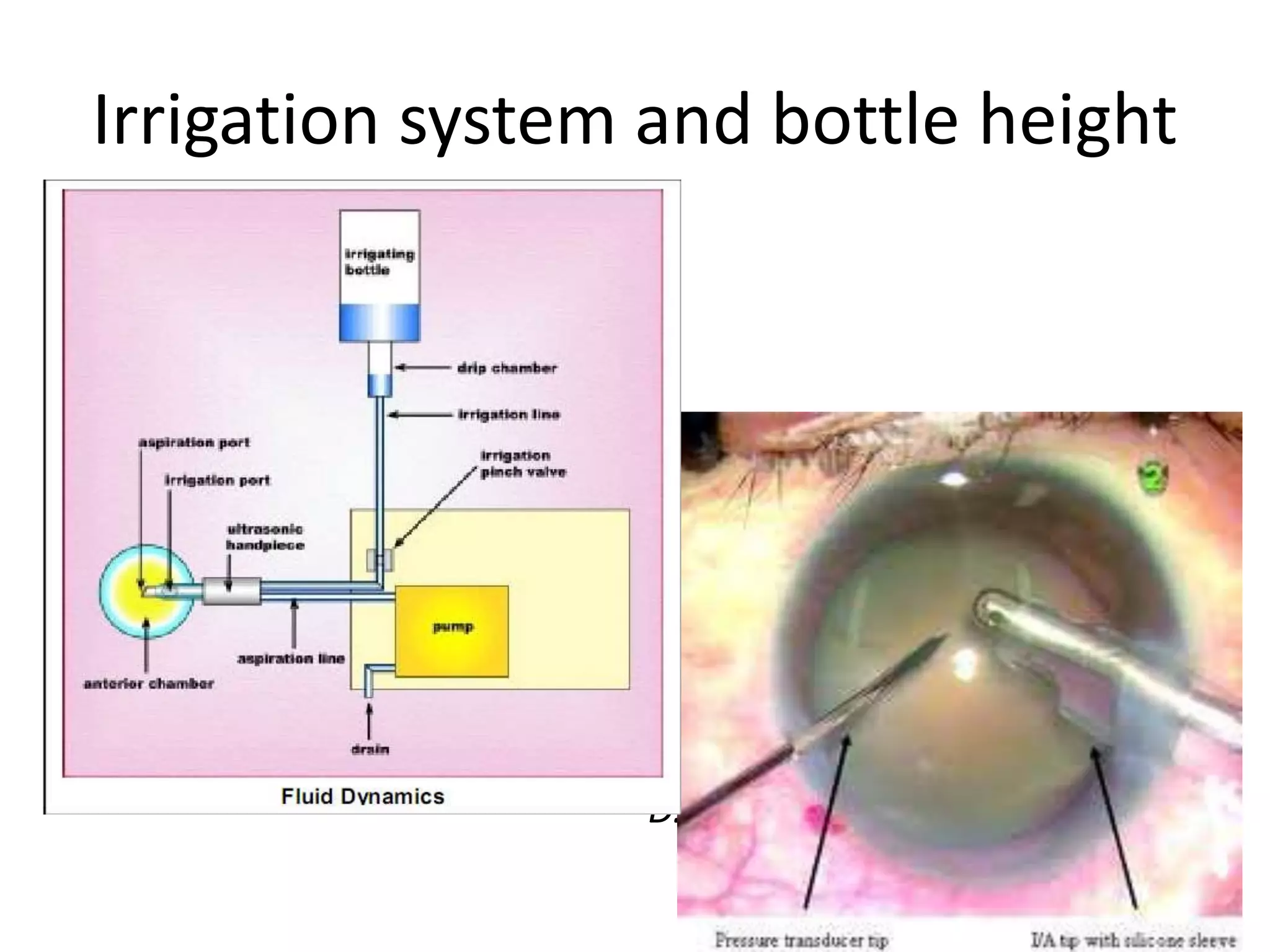 Phacodynamics basics! | PPTX